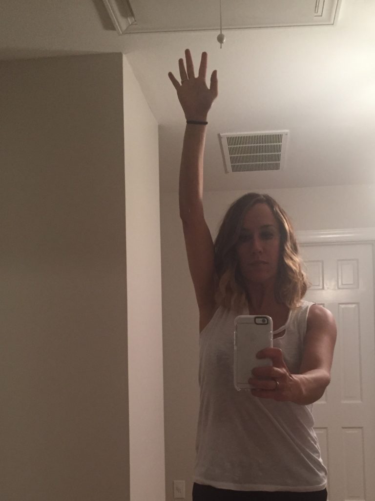 Day 20 Post-Op - Dr. Meaghan Dishman